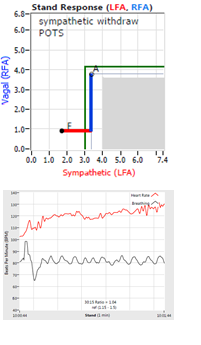 What is Postural Orthostatic Tachycardia Syndrome (POTS)