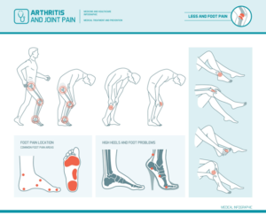 hEDS & HSD Symptoms: Pain, Fatigue & Misdiagnosis